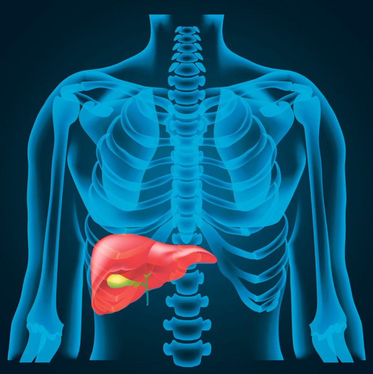 "Gunoierii" organismului - FICATUL și FIEREA - Formula AS