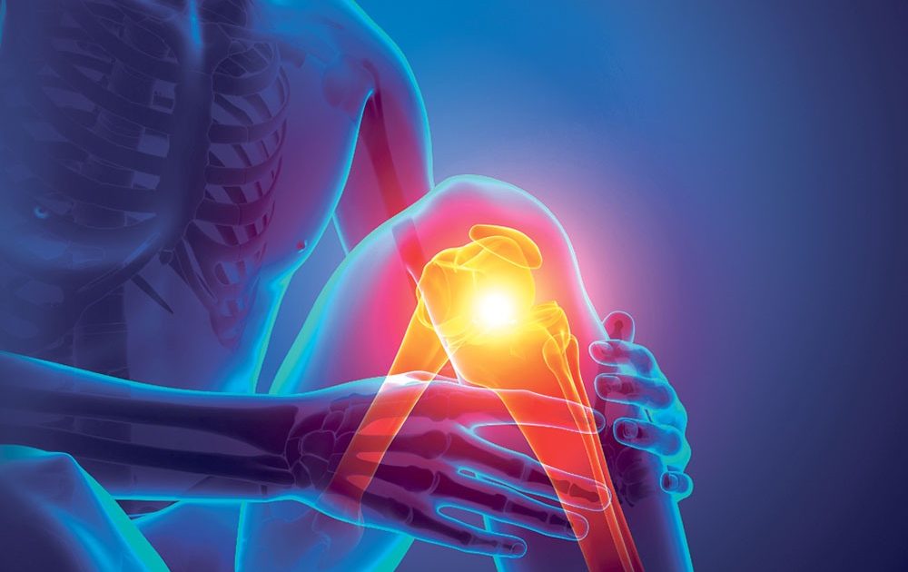 Protezele de genunchi - Dr. SEVER SEBASTIAN OANĂ (medic specialist ...